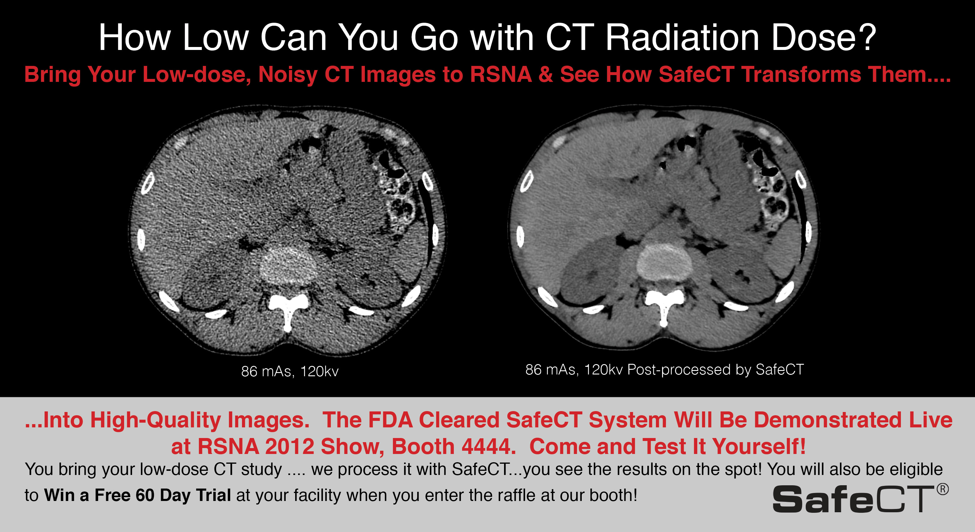 The Most Important thing to Bring to RSNA: CT Images!