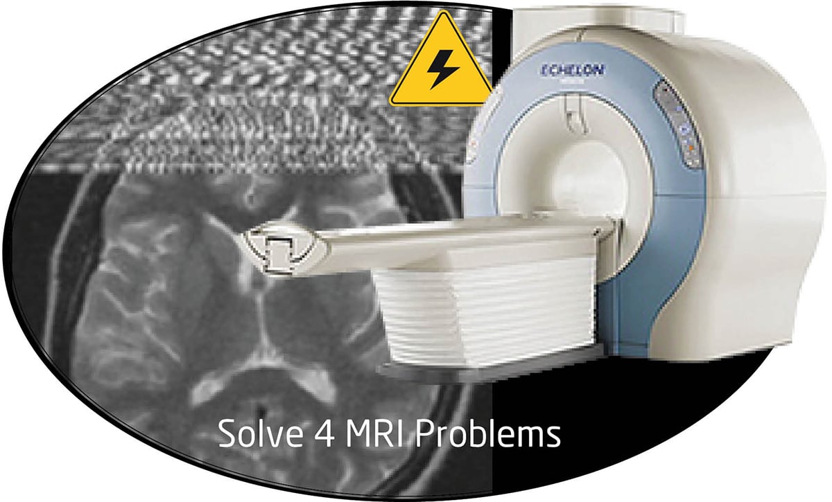 4 Tips to Solve MRI Service Issues