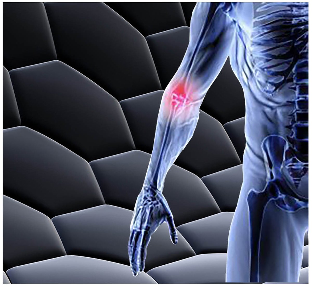 Spectral CT Technology & Microfractures
