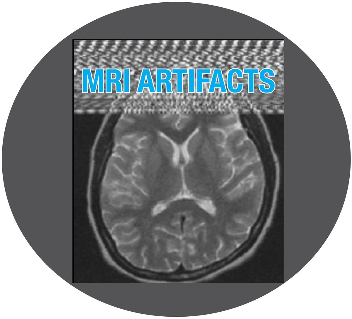 The Importance of Reading Artifacts in MRI