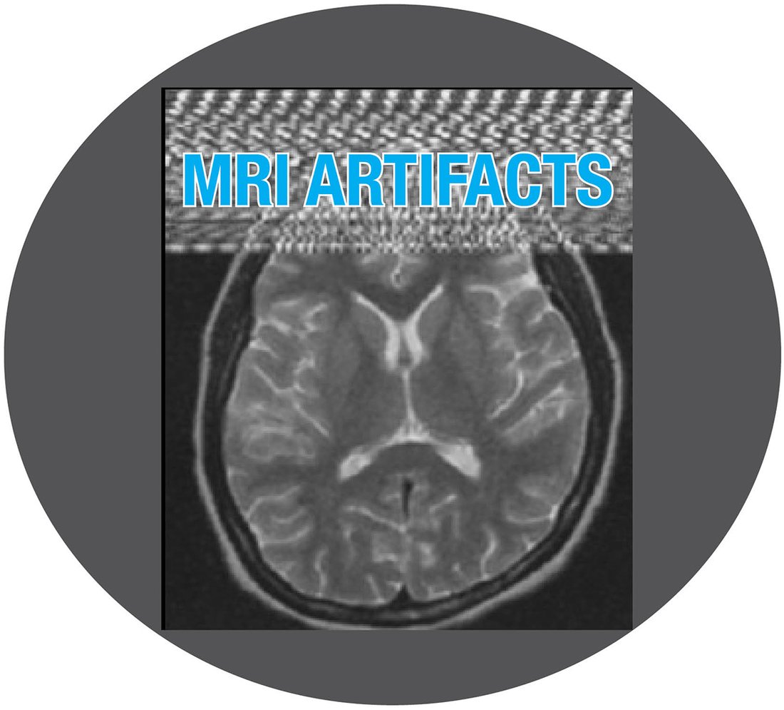 The Importance of Reading Artifacts in MRI