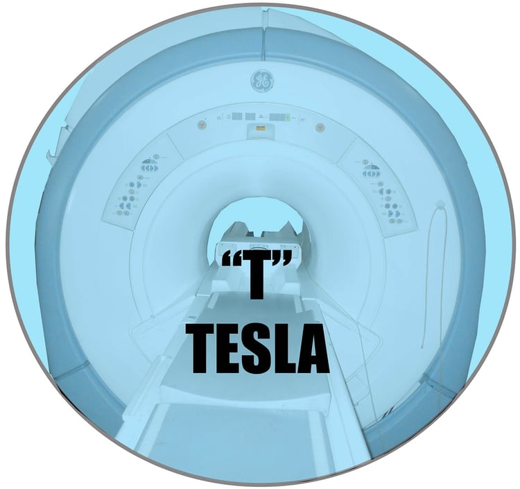 MRI Tesla: What’s the difference?