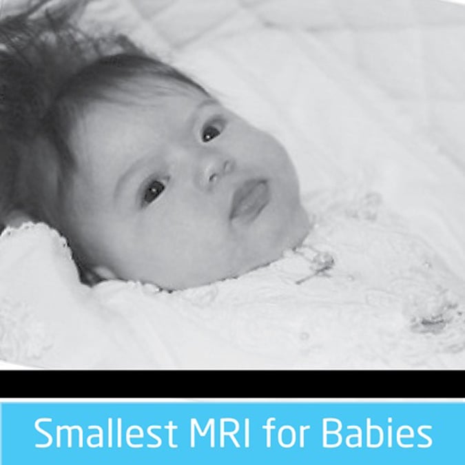 Pioneering the Smallest MRI for Babies