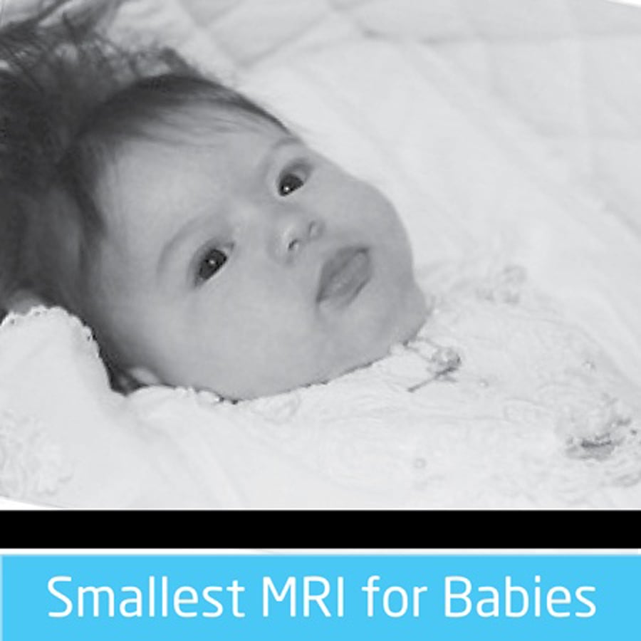 Pioneering the Smallest MRI for Babies