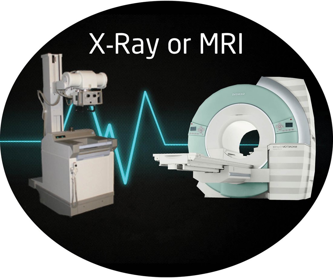 MRI or X-Ray?