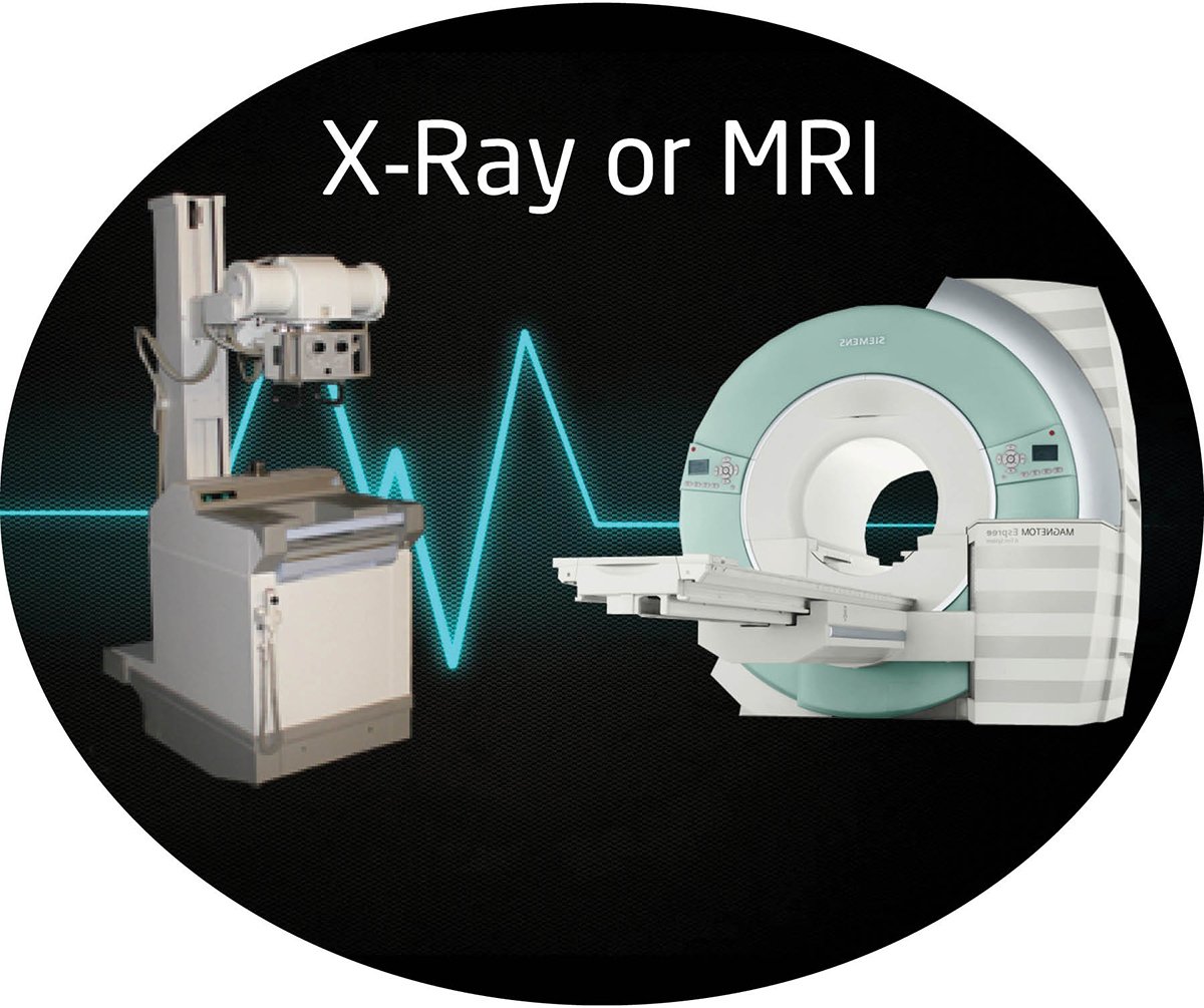 MRI or X-Ray?
