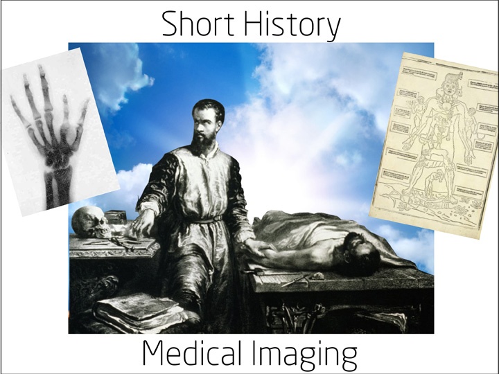 Around 275 B.C. Medical Imaging Was Born…Really?