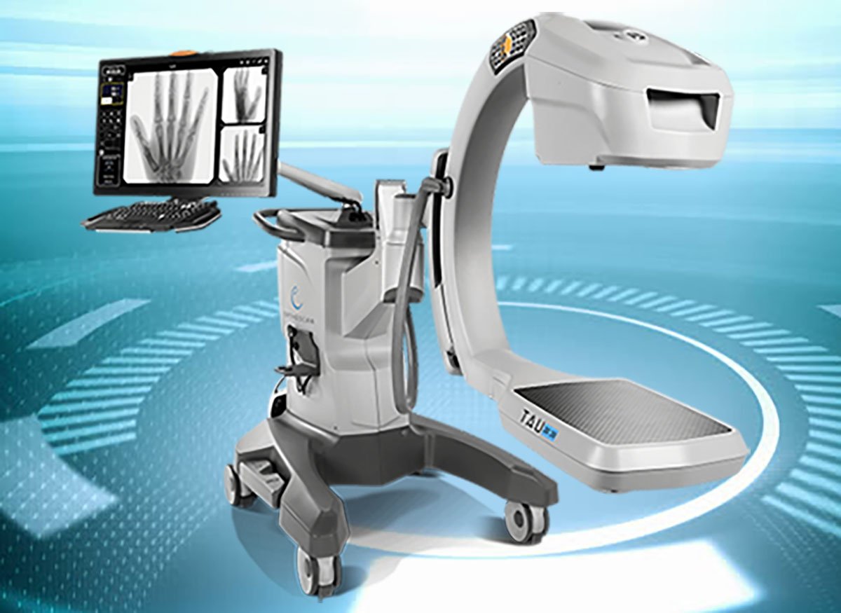 New Mini C-Arm for Pediatrics