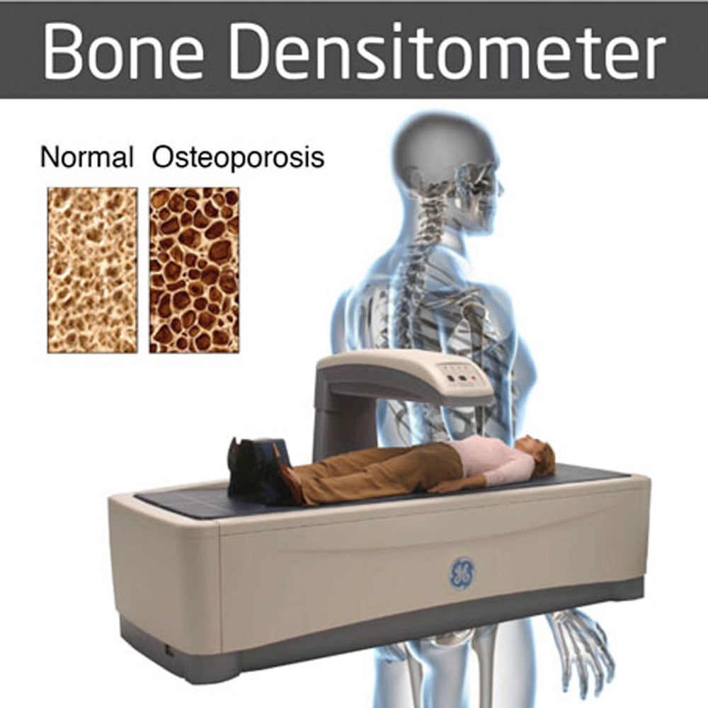 Everything You Want to Know About Bone Densitometers